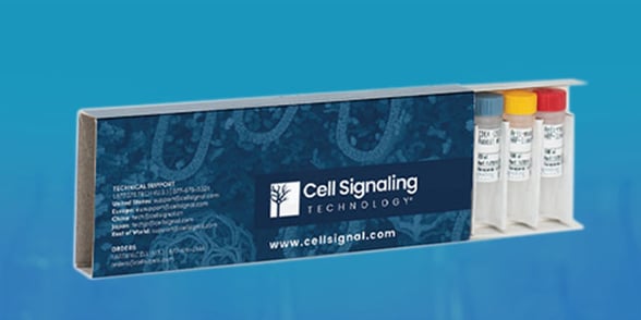 Antibody Samplerキット15% OFFキャンペーン*